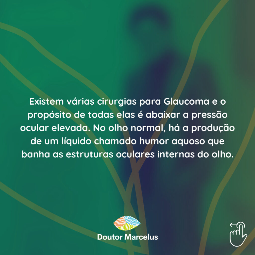 GONIOTOMIA. MAIS UM TIPO DE CIRURGIA EM GLAUCOMA. – Doutor Marcelus Layguel