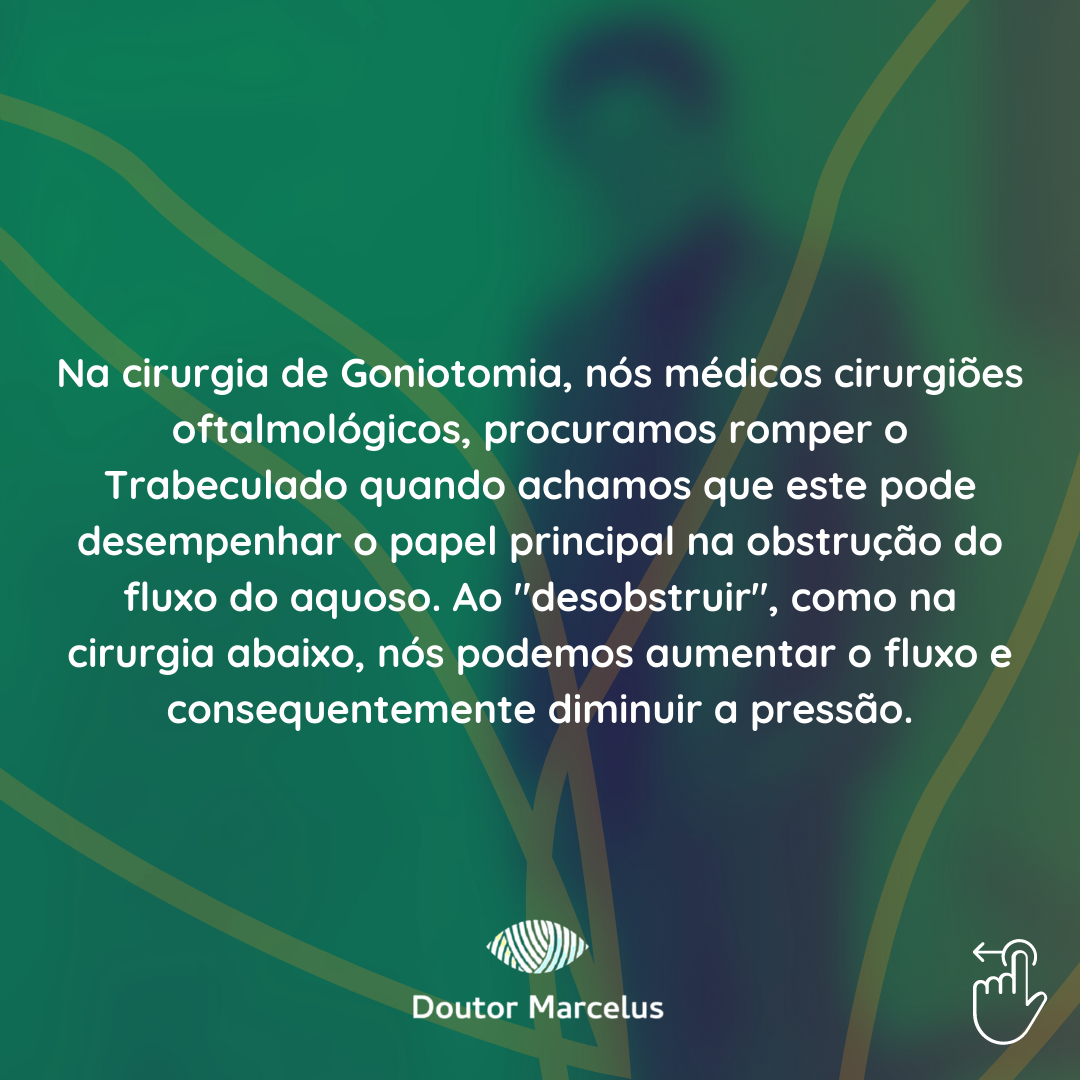 GONIOTOMIA. MAIS UM TIPO DE CIRURGIA EM GLAUCOMA. – Doutor Marcelus Layguel